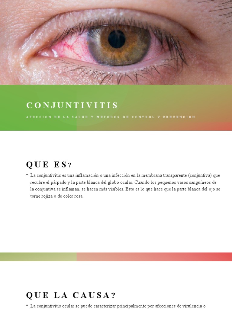 CONJUNTIVITIS | PDF | Alergia | Virus