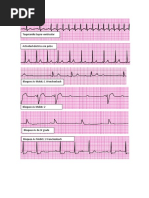 Guía para Trabajo Preliminar y Autoevaluación ACLS | PDF | Relaciones ...