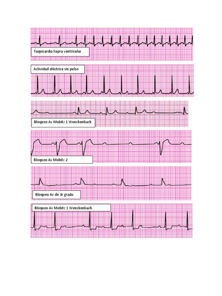 Bls Acls | PDF | Reanimación cardiopulmonar | Sistema cardiovascular