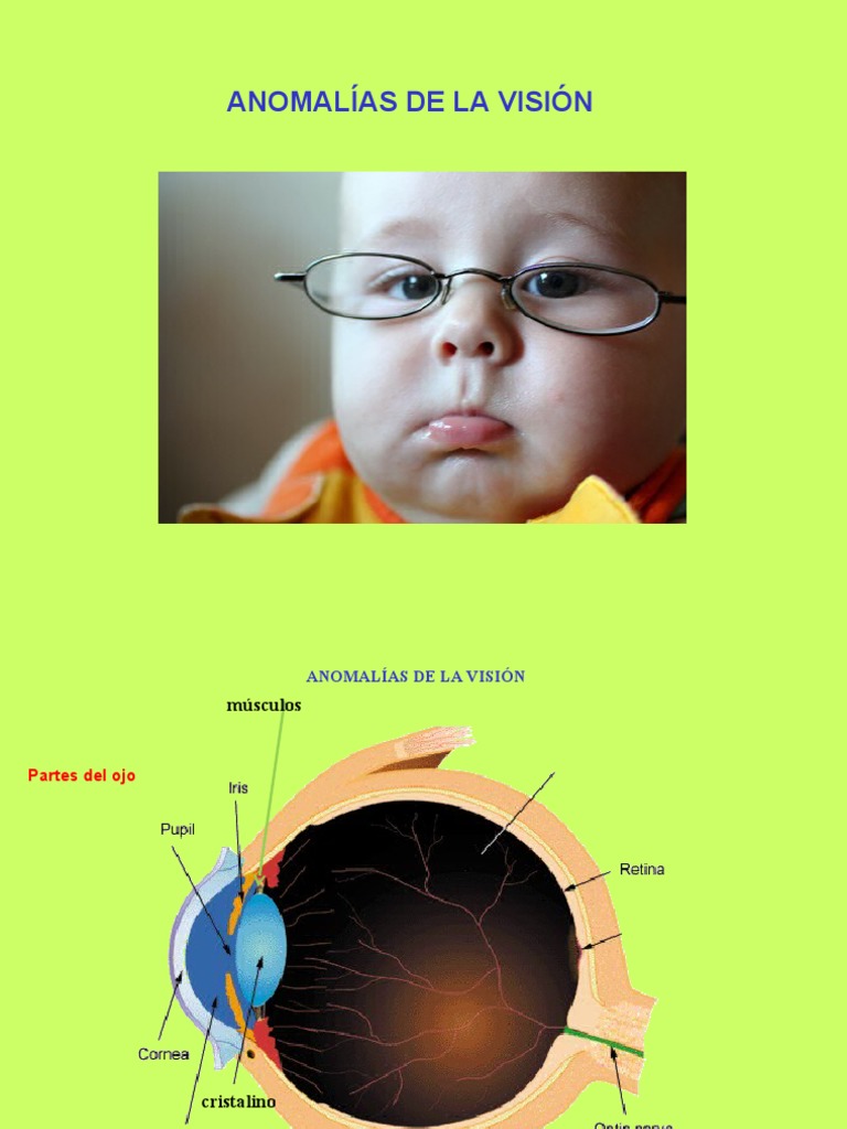 Anomalias de La Vision | PDF