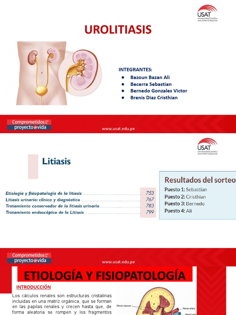 Urolitiasis | PDF | Antiinflamatorio | Medicina CLINICA