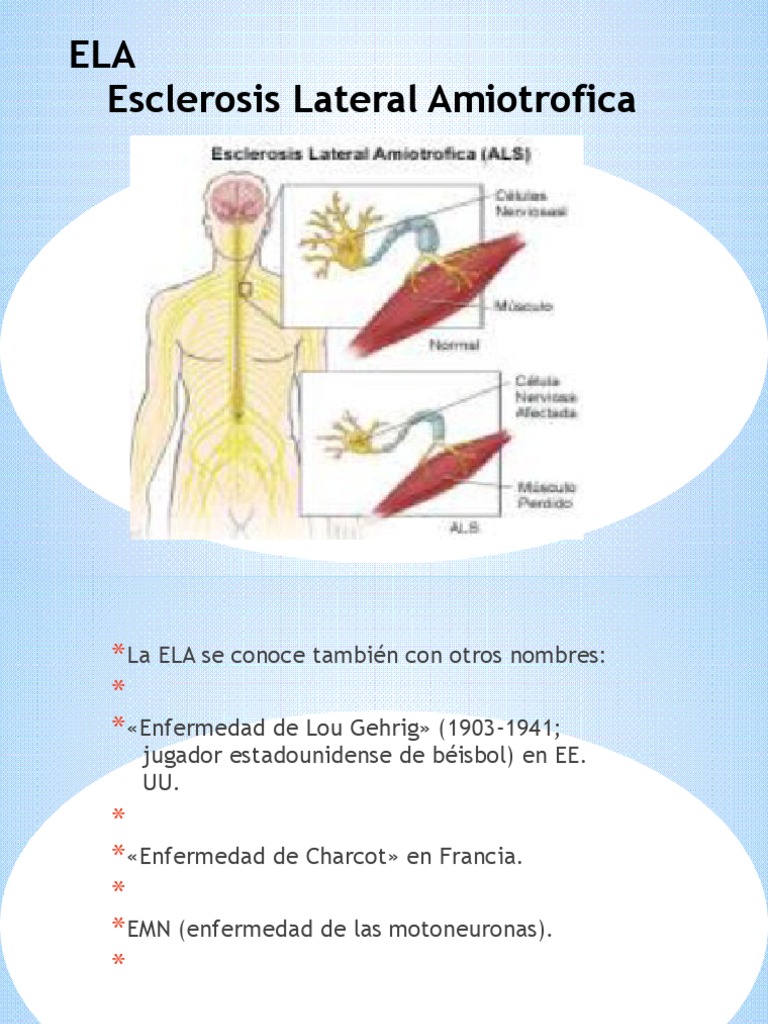 Esclerosis Lateral Amiotrófica: Guía Completa | PDF | La esclerosis ...