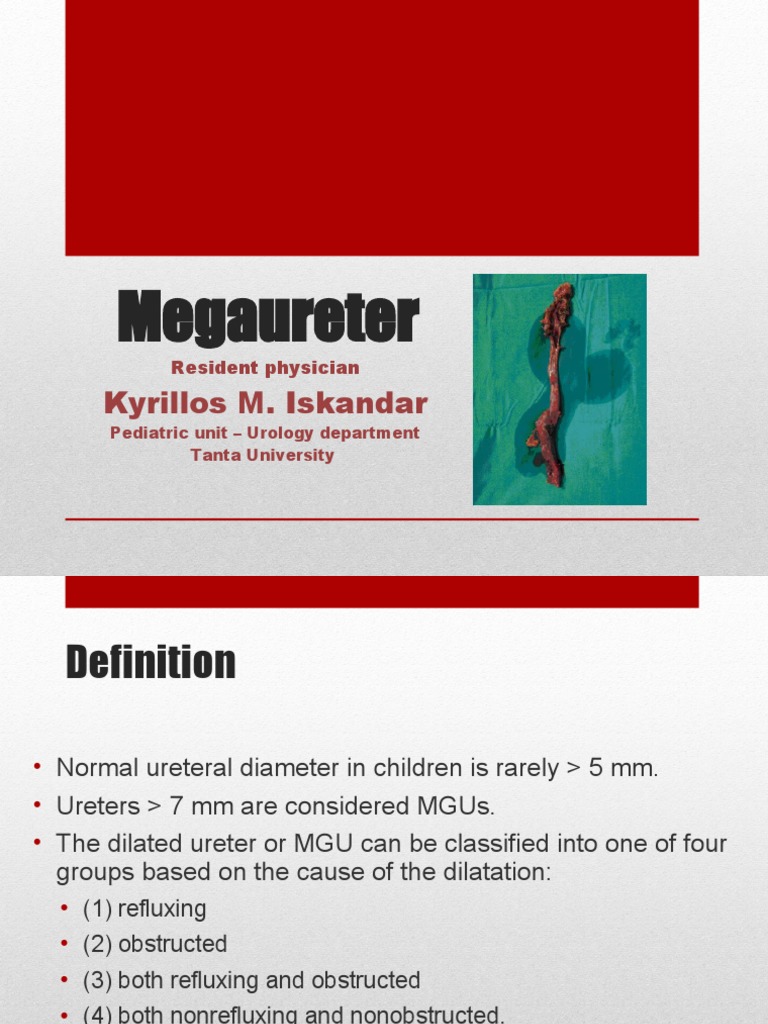 Megaureter | PDF | Clinical Medicine | Causes Of Death