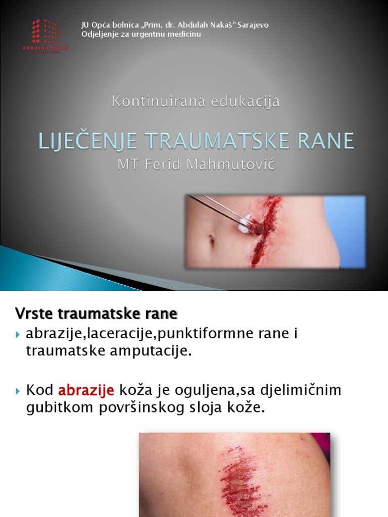 Lijecenje Traumatske Rane | PDF