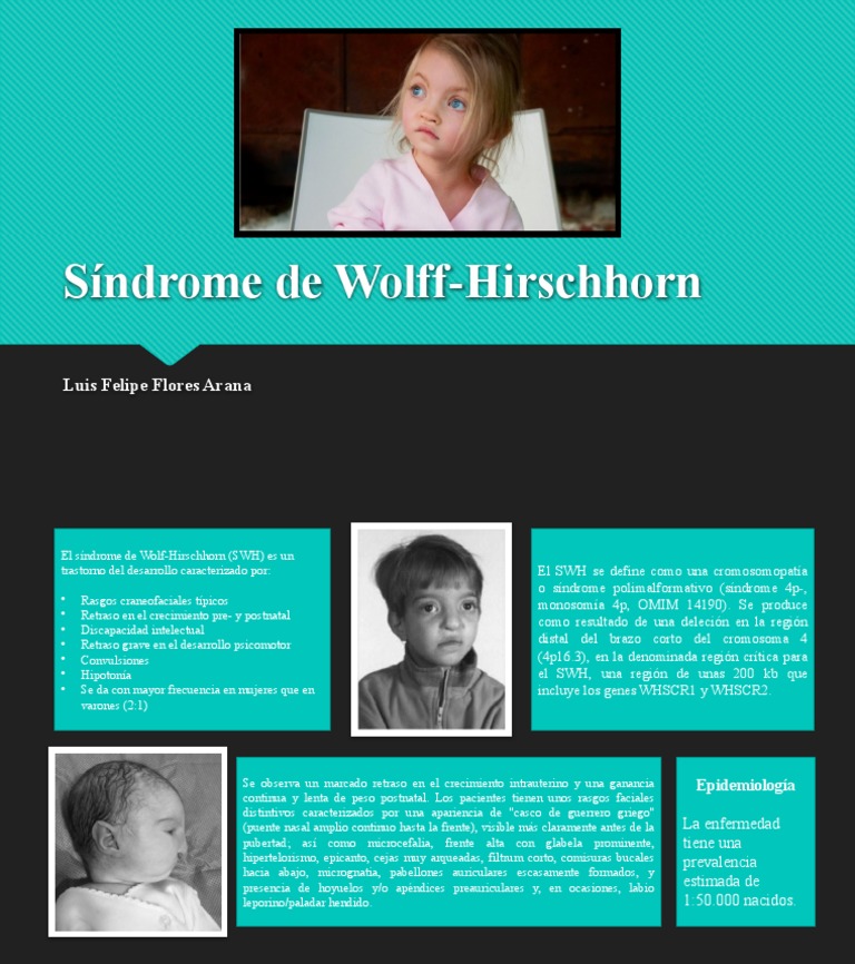 Síndrome de Wolff-Hirschhorn | PDF