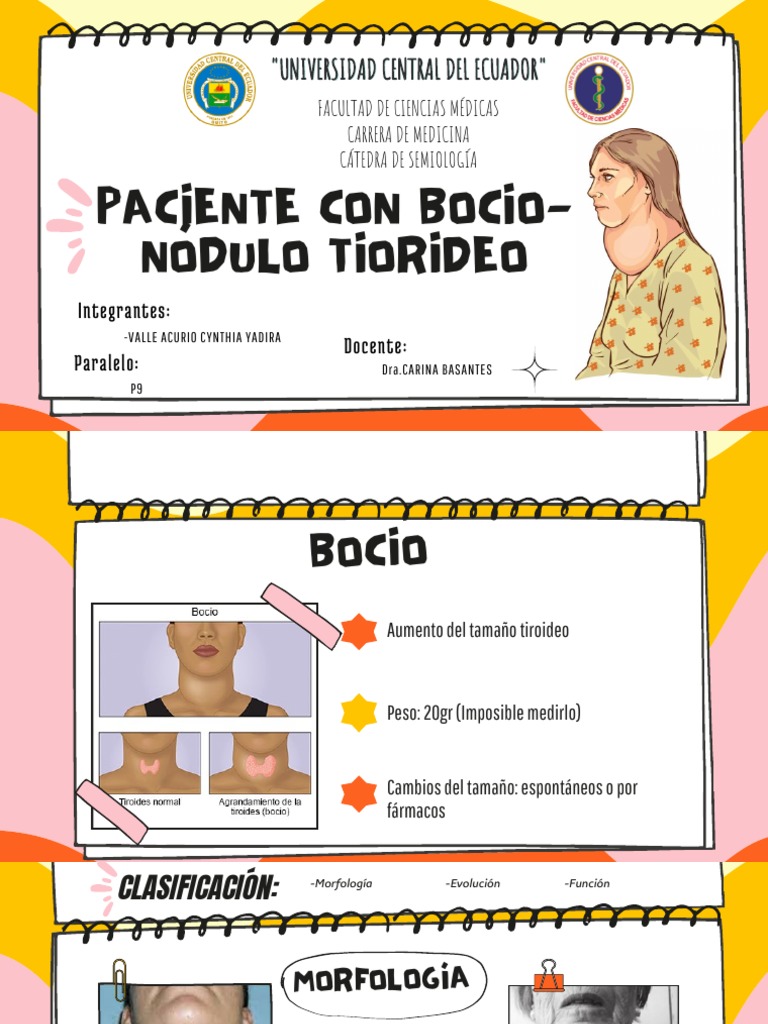Diagnóstico y Clasificación del Bocio | PDF