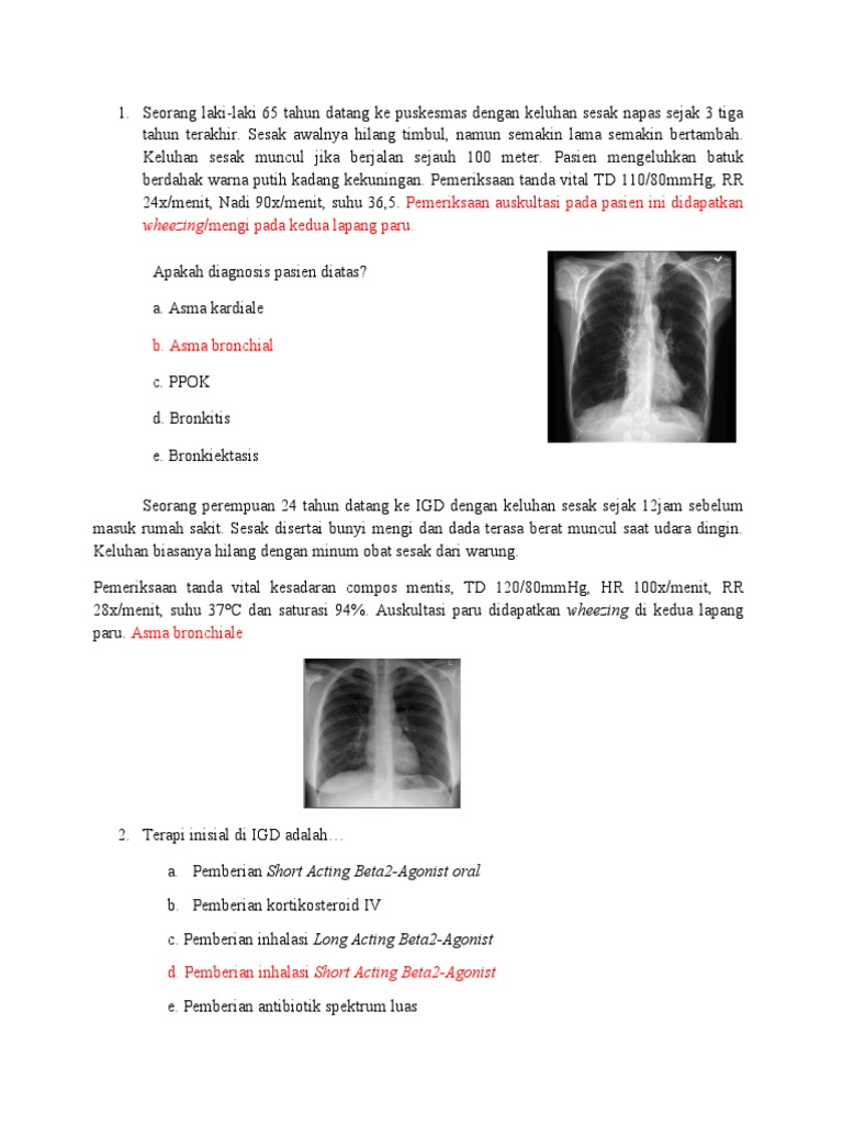 Soal Paru Koas | PDF