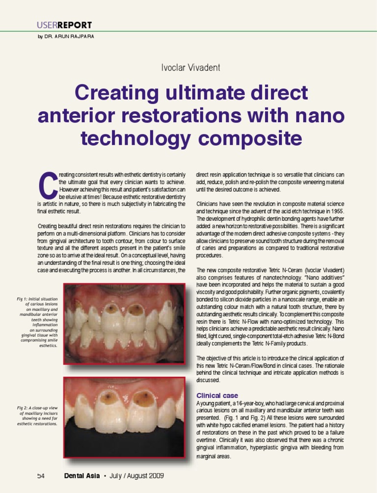 Nano Composite | PDF | Dental Composite | Dentistry