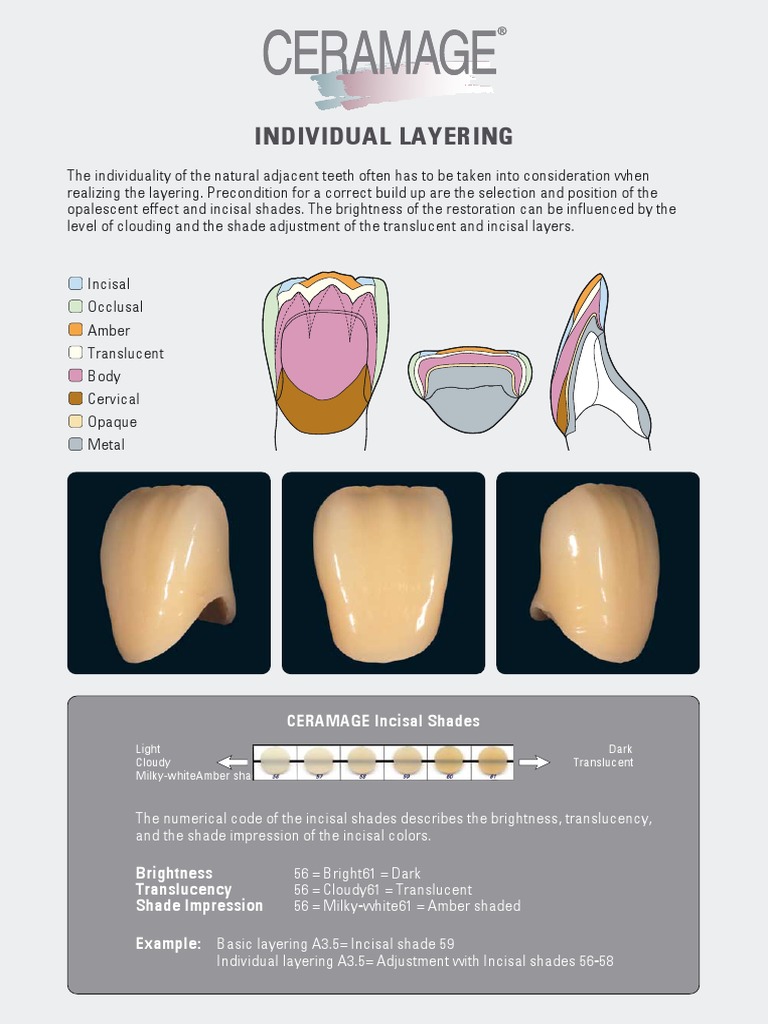 Ceramage Schichtkarte UK 2006 04 | PDF | Mouth | Dentistry