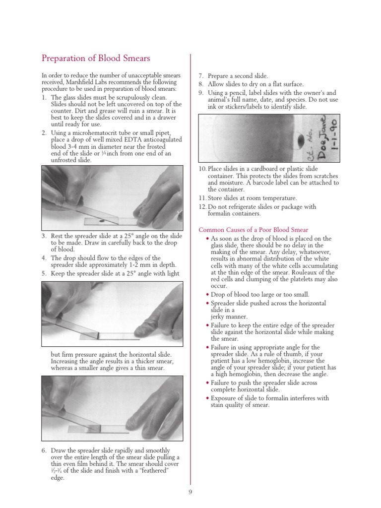 Preparation of Blood Smears.1 | PDF | Body Fluids | Tissue (Biology)