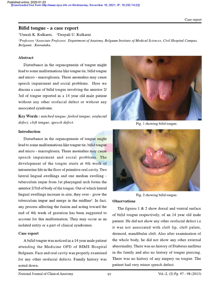 Understanding Bifid Tongue | PDF | Computers