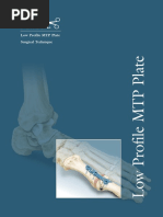V2 71081187 REVA SMART TSF Surgical Technique 0122 | PDF | Screw | Nut ...