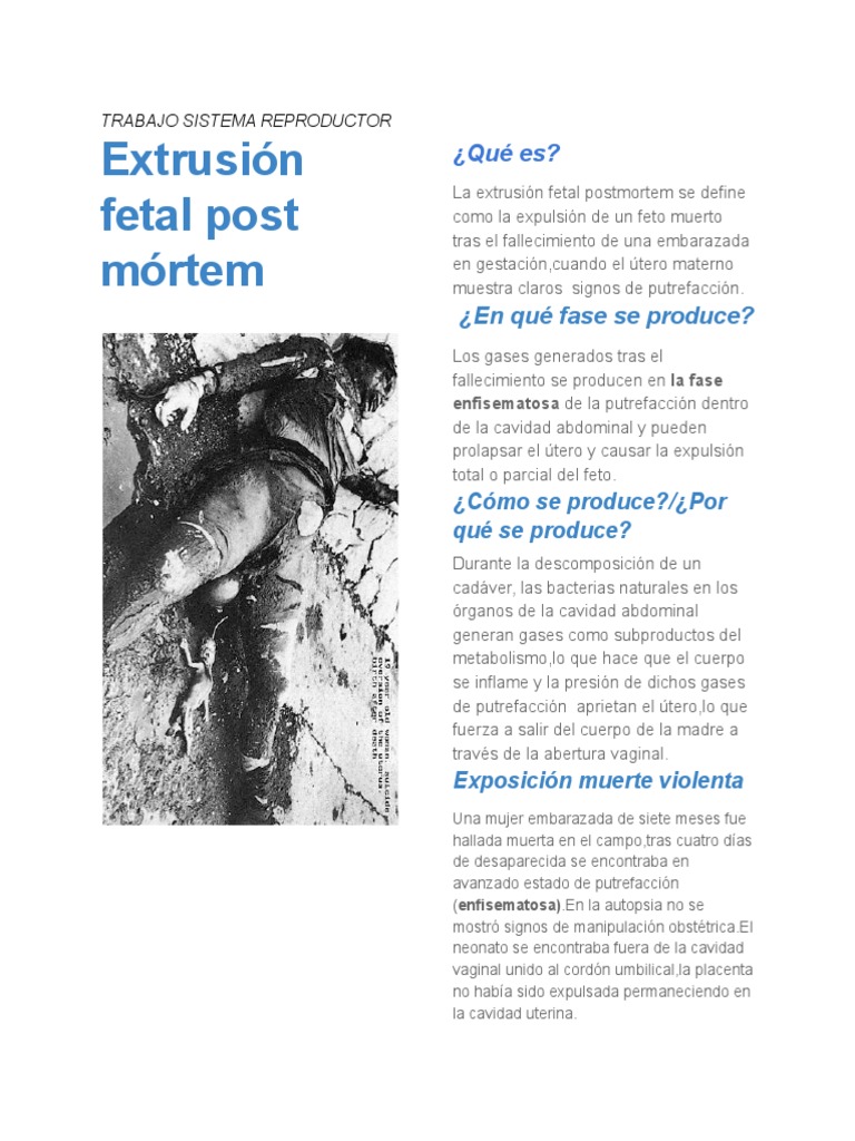 Extrusión Fetal Postmortem | PDF