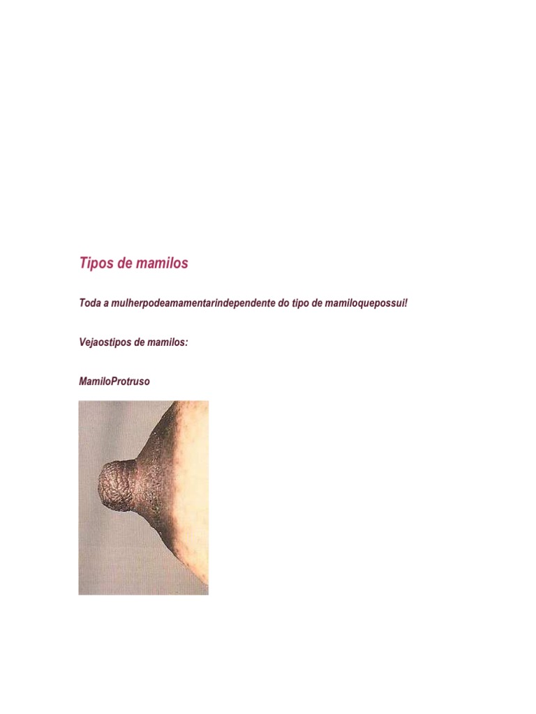 Tipos de Mamilos | PDF