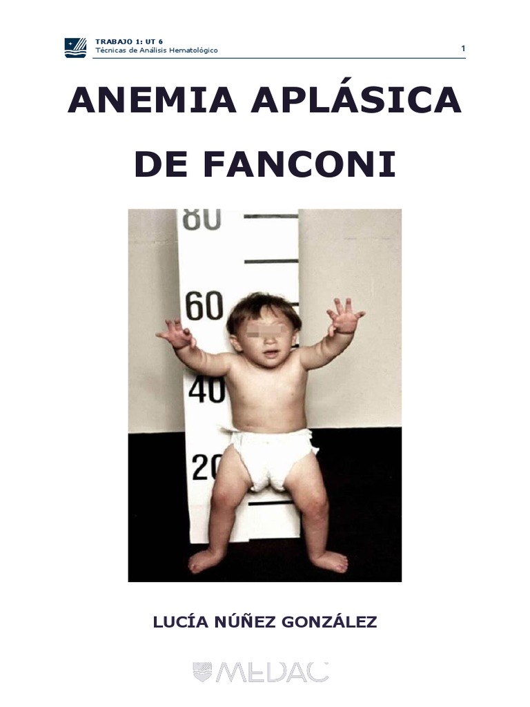 Anemia de Fanconi | PDF