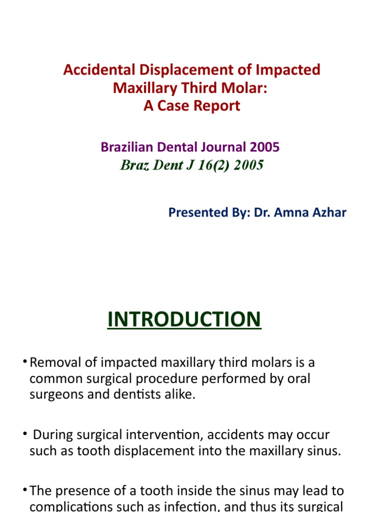Accidental Displacement of Impacted Maxillary Third Molar JC 2 | PDF ...