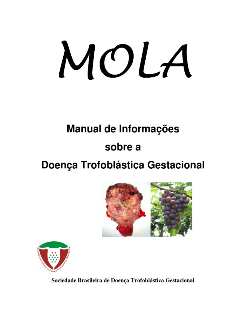 Manual Mola | PDF | Gravidez | Placenta