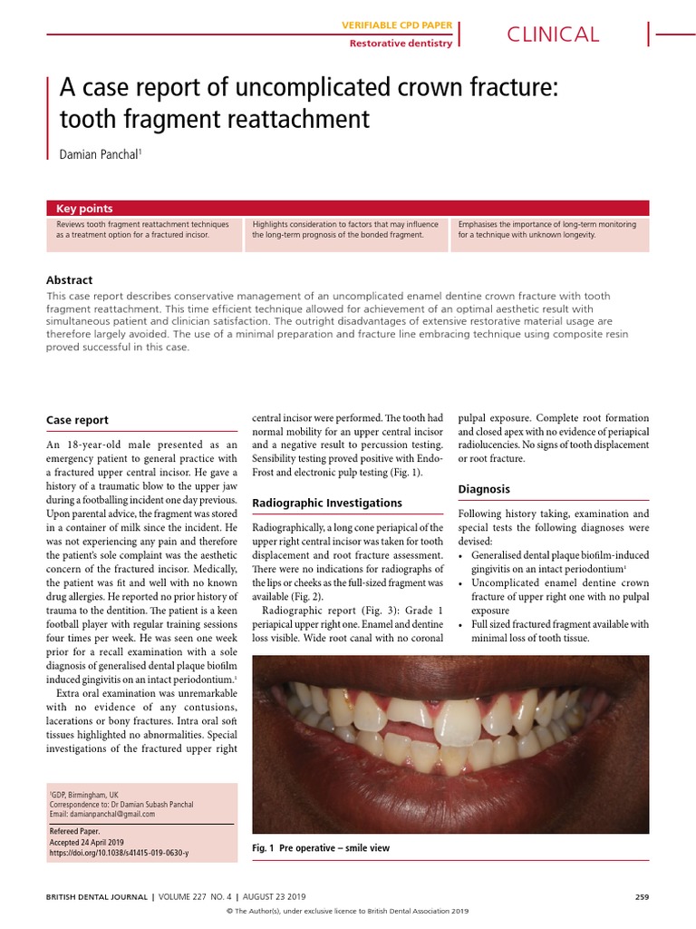 A Case Report of Uncomplicated Crown Fracture - Tooth Fragment ...