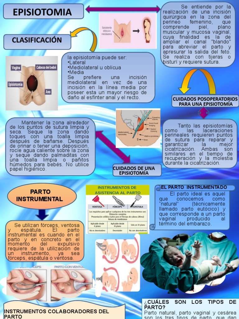 Laminas Episiotomia | PDF | Parto | Salud pública