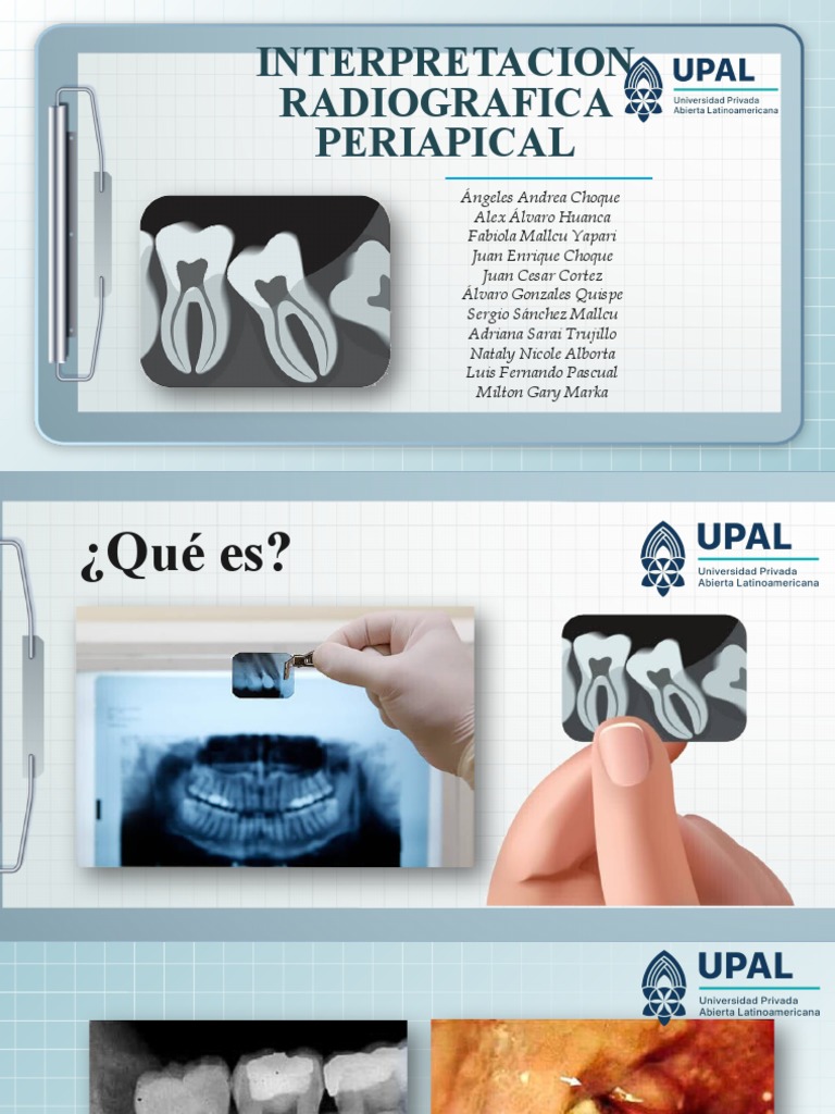Interpretacion Radiologica Periapical | PDF | Especialidades Medicas ...
