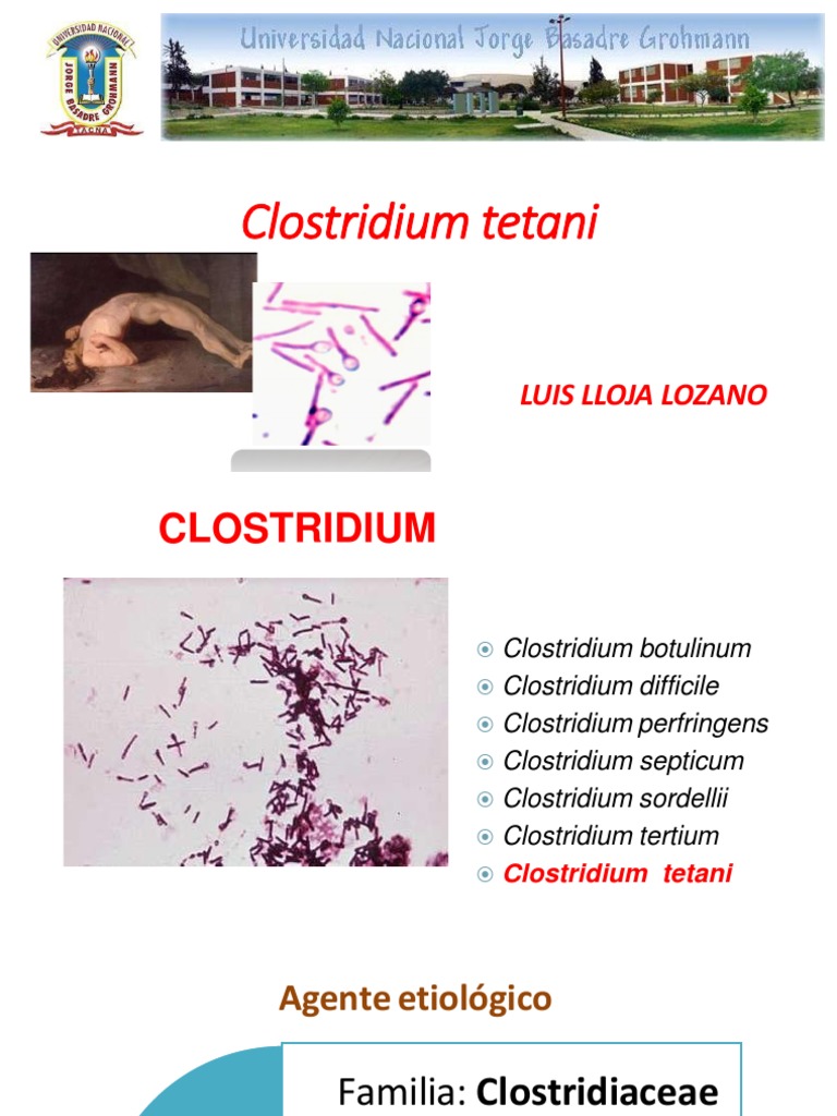 Tema. Clostridium Tetani | PDF | Especialidades Medicas | Medicina CLINICA