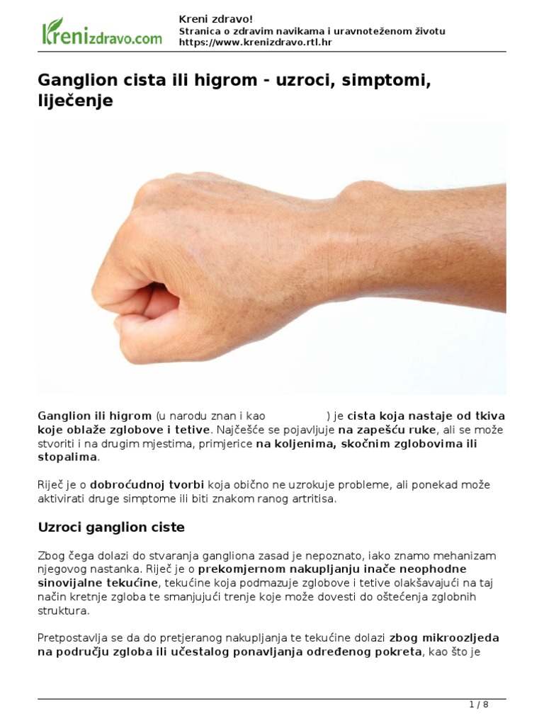 Ganglion Cista Ili Higrom Uzroci Simptomi Lijecenje | PDF