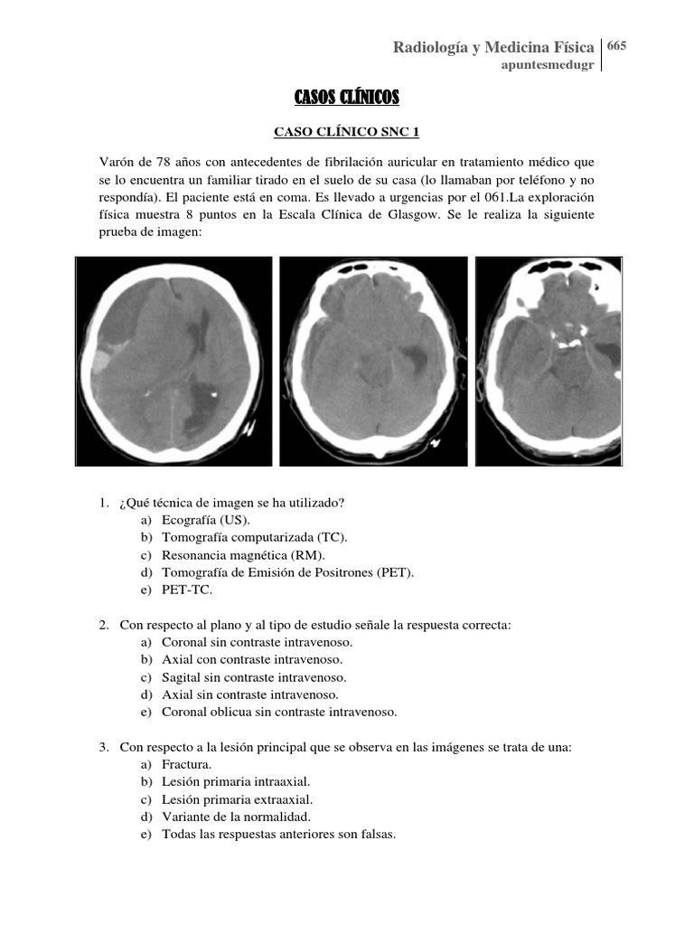 Rayos (Material Complementario) (No Copi) | PDF | Ct Scan | Imagenes medicas