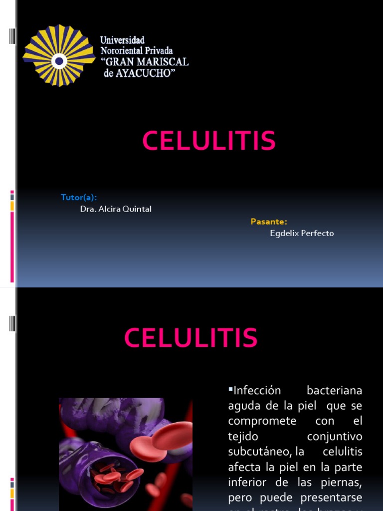 CELULITIS | PDF | Inmunología | Enfermedades y trastornos