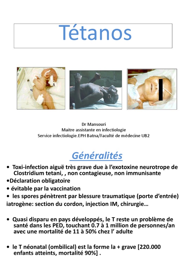 Tetanos 1 | PDF | Infection | Physiologie
