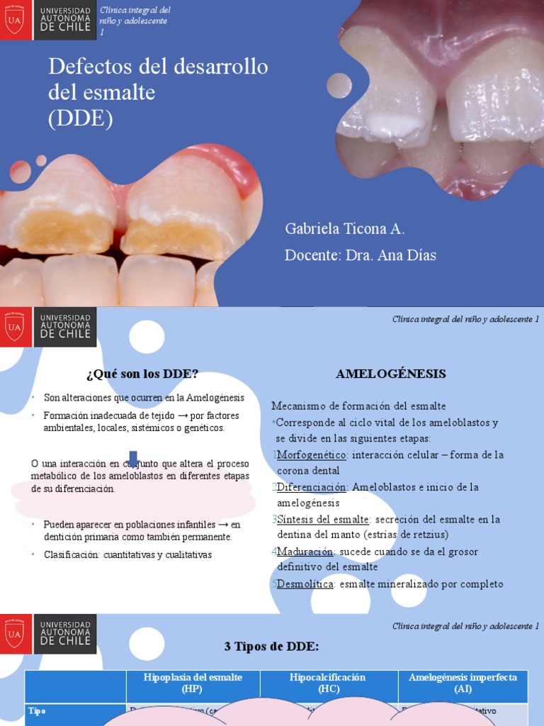 Defectos Del Desarrollo Del Esmalte | PDF | Esmalte de dientes | Diente