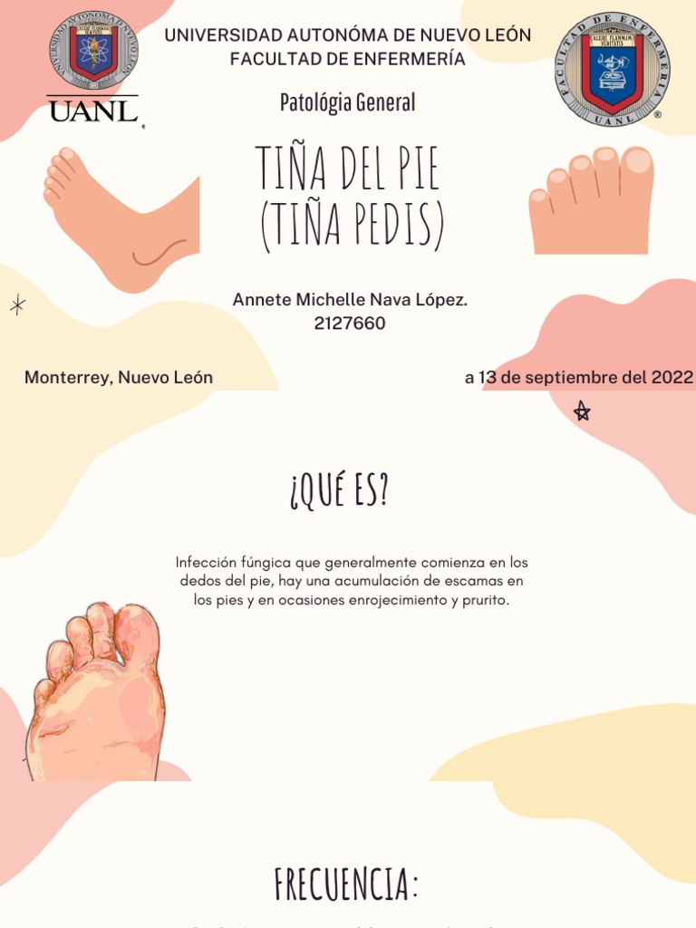 Tiña Pedis, Pie de Atleta | PDF | Epidemiología | Medicina CLINICA