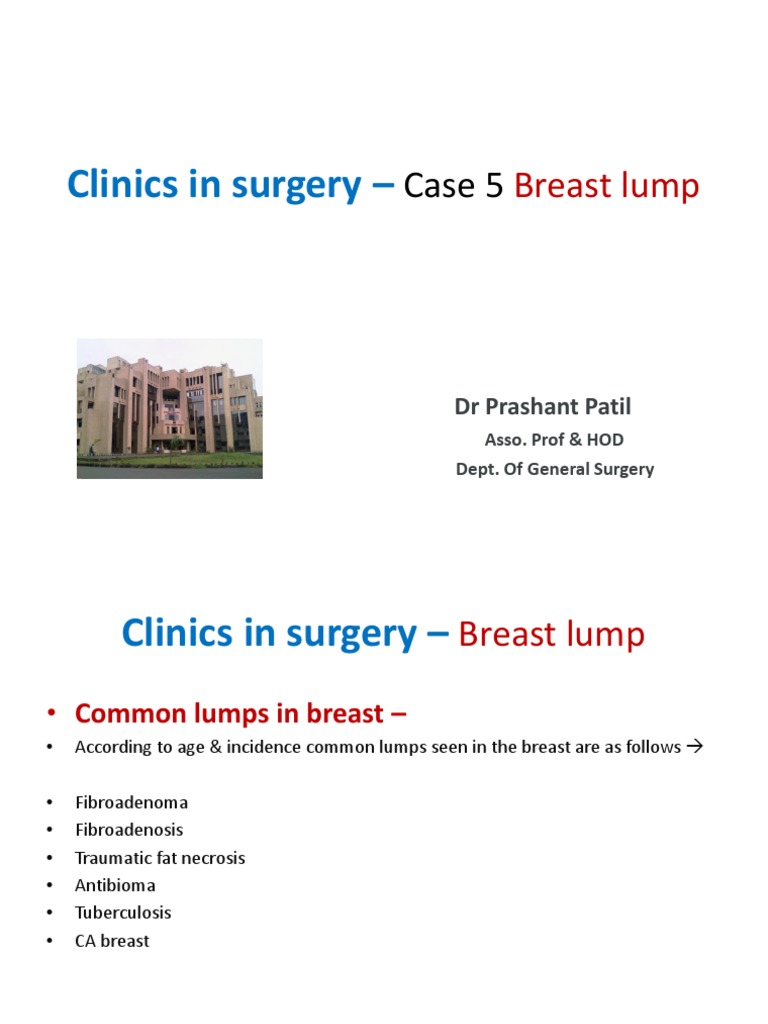 Clinics in Surgery - Case 5 Breast Lump | PDF | Breast Cancer | Breast