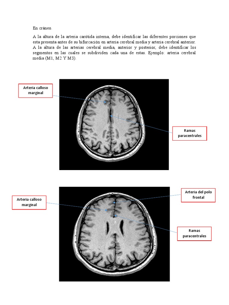 Anatomia Multiplanar | PDF | Angiología | Anatomía humana