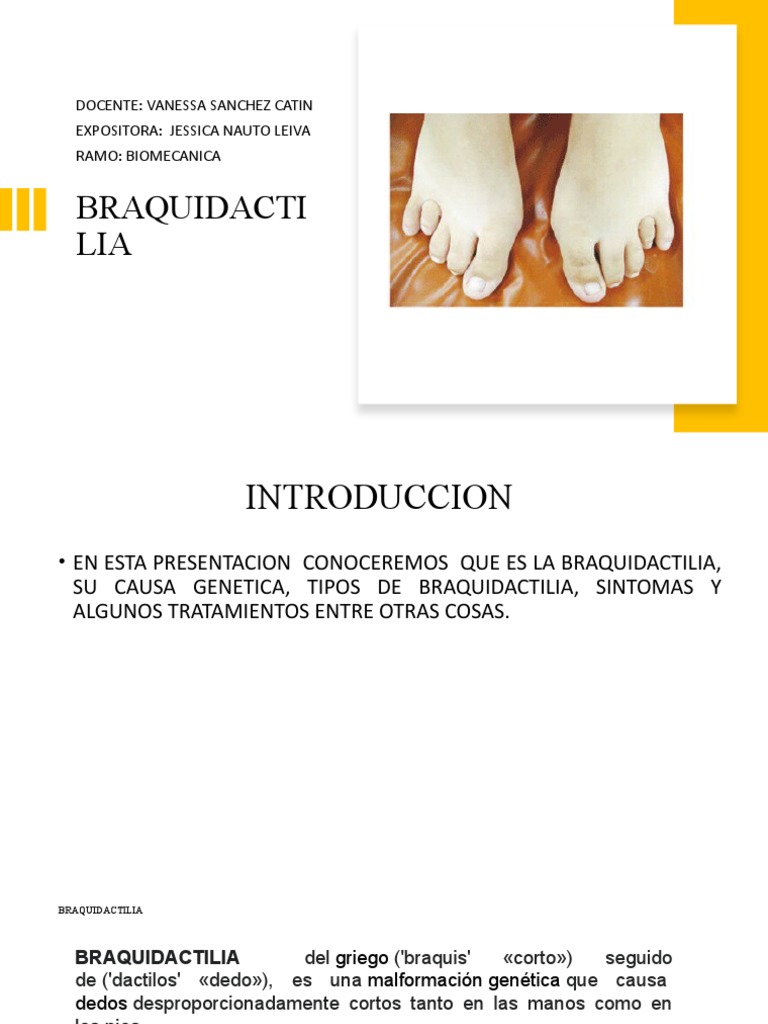 BRAQUIDACTILIA | PDF | Pie | Mano