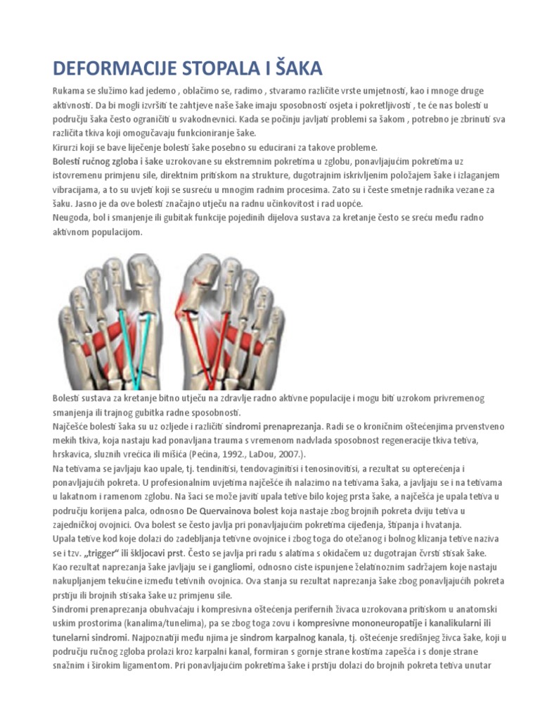 Deformacije Stopala I Šaka | PDF