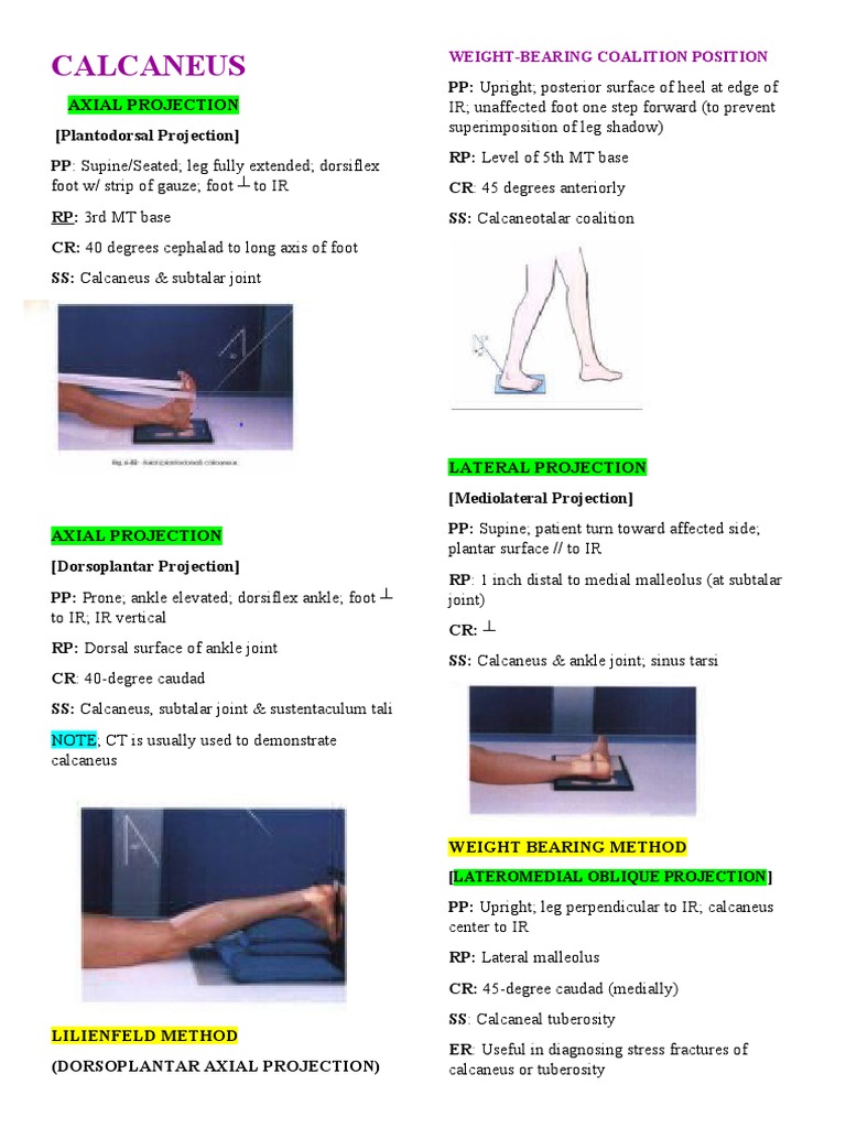 Calcaneus: Weight-Bearing Coalition Position | PDF | Ankle | Foot