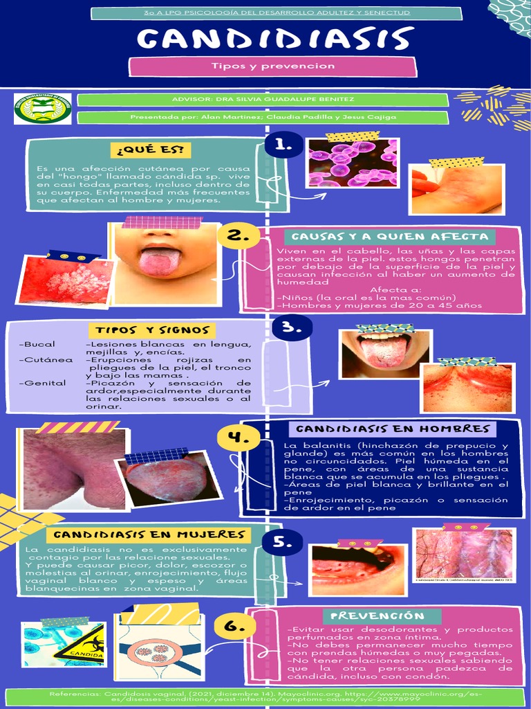 Infografía Candidiaasis | PDF | Candidiasis | Causas de la muerte