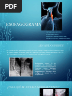 Niveles Axilares de Berg | PDF | Finanzas y dinero