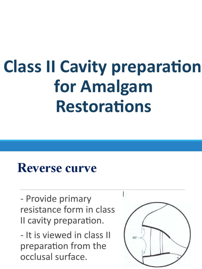 Class II Cavity Preparation - 2 | PDF | Tooth Enamel | Dentin