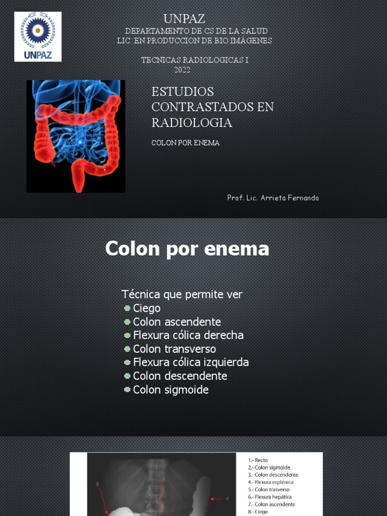 Colon Por Enema | PDF | Intestino grueso | Medicina