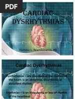 Cardiac Dysrhythmia Chart Med-Surg NUR4 | PDF | Cardiac ...