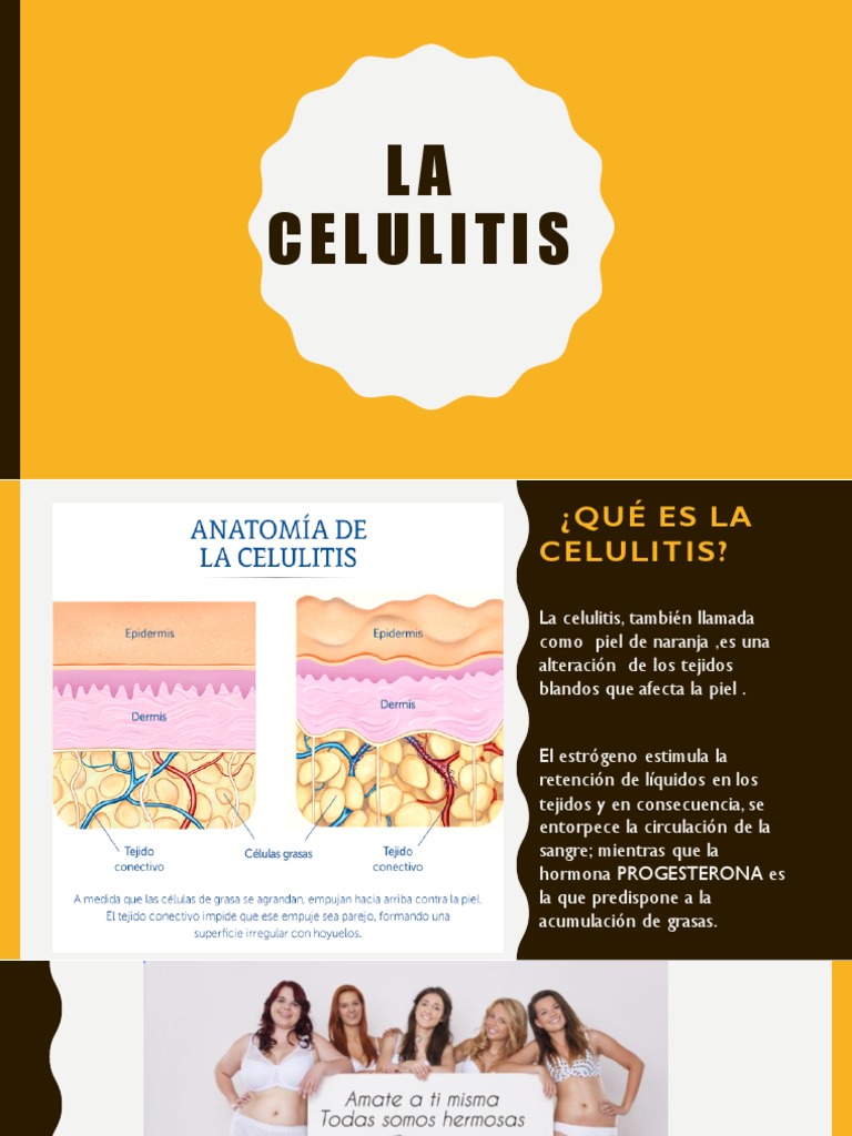 La Celulitis | PDF | Medicina CLINICA | Especialidades Medicas
