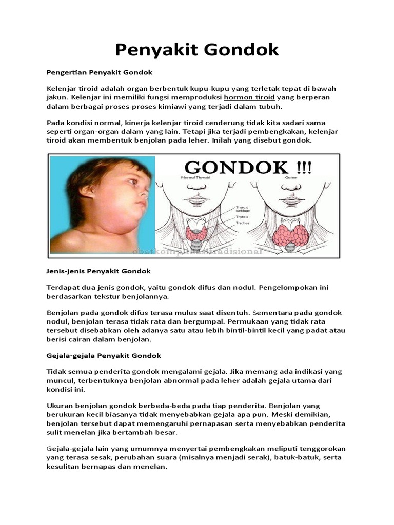 Penyakit Gondok | PDF