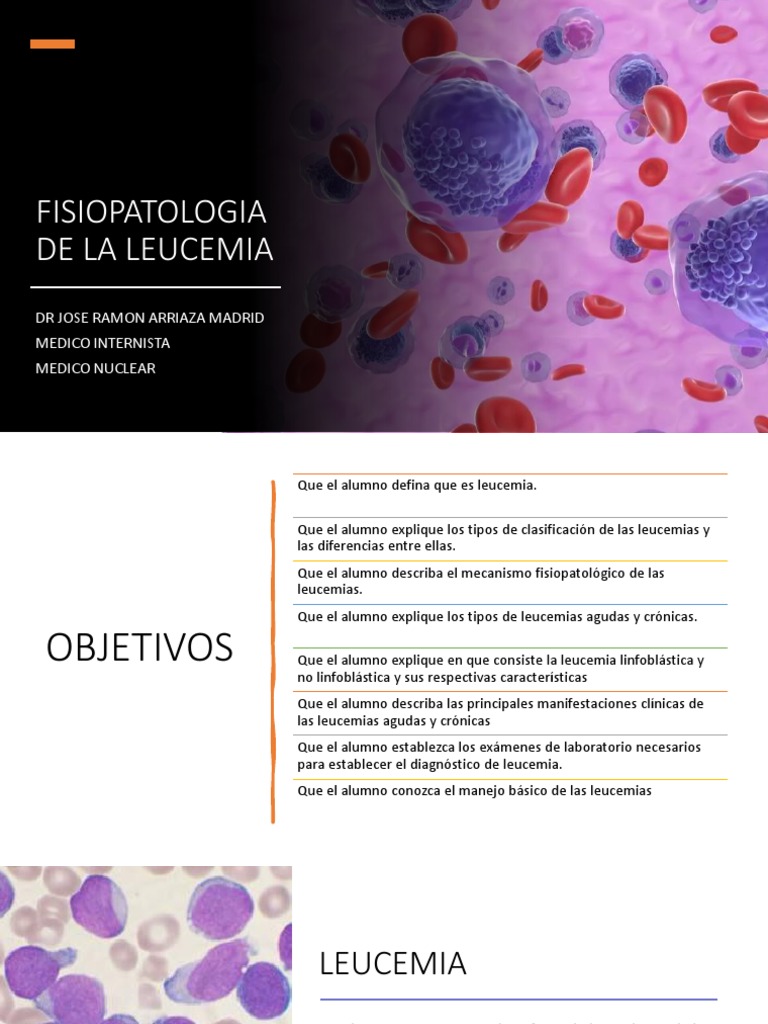 Fisiopatología de La Leucemia | PDF | Leucemia | Medicina CLINICA