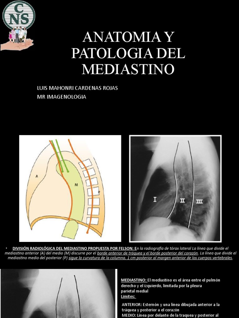 Anatomia y Patologia Del Mediastino | PDF | Tórax | Pulmón