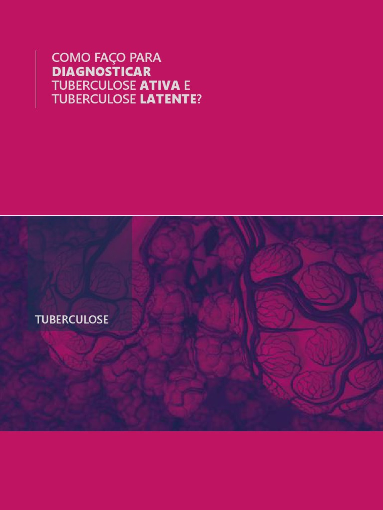 Tuberculose | PDF | Tuberculose | Mycobacterium tuberculosis