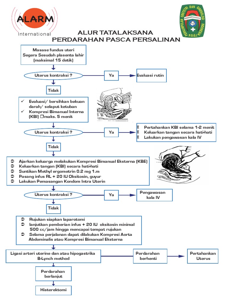 2 Alur Tatalaksana Perdarahan Pasca Persalinan | PDF