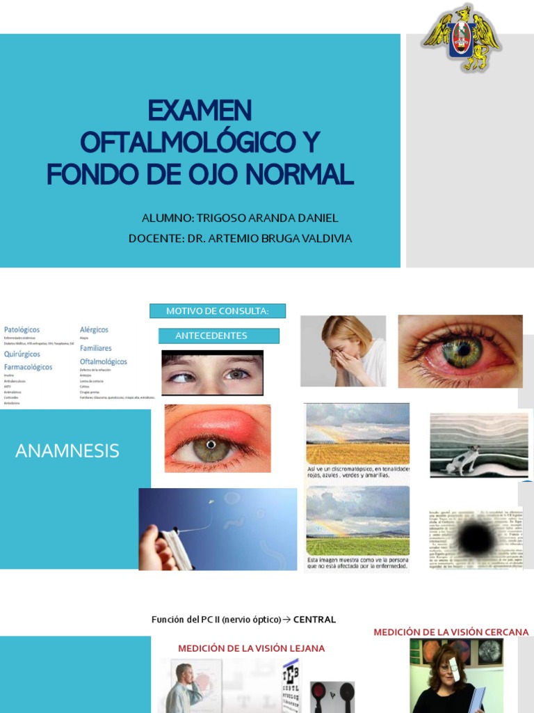 Examen Oftalmológico y Fondo de Ojo | PDF | Ojo humano | Percepción visual