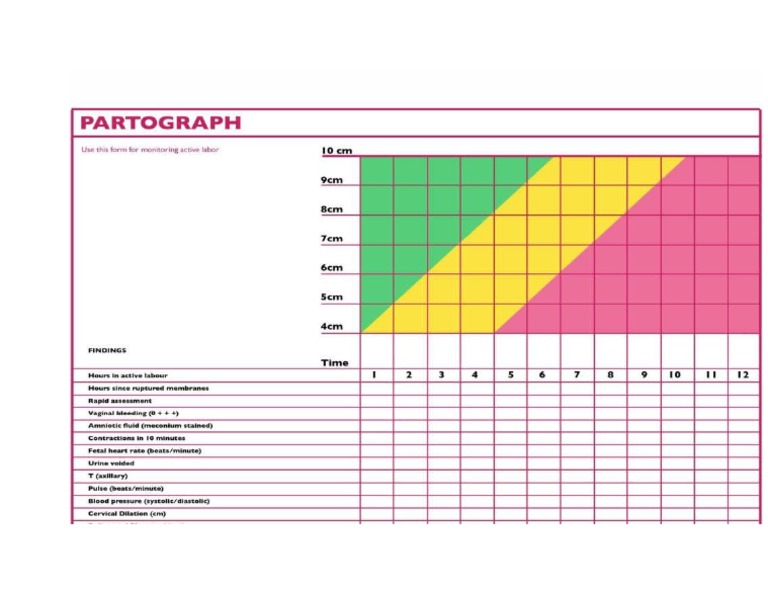 Partograph Form | PDF
