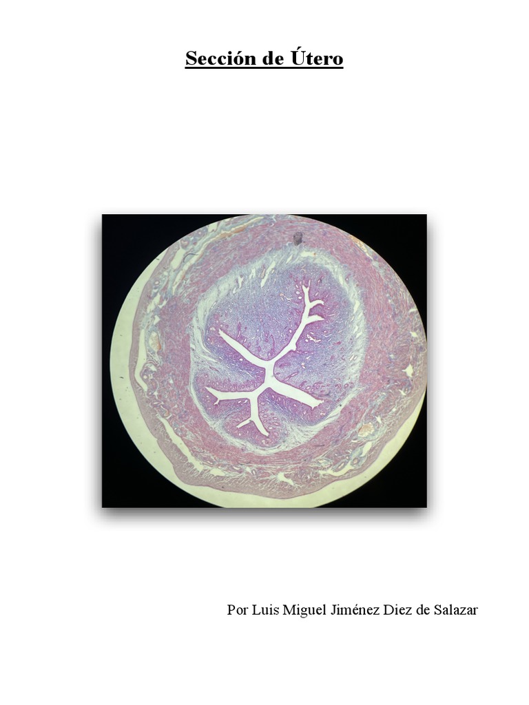 Sección de Útero | PDF | Útero | Implantación (embrión humano)